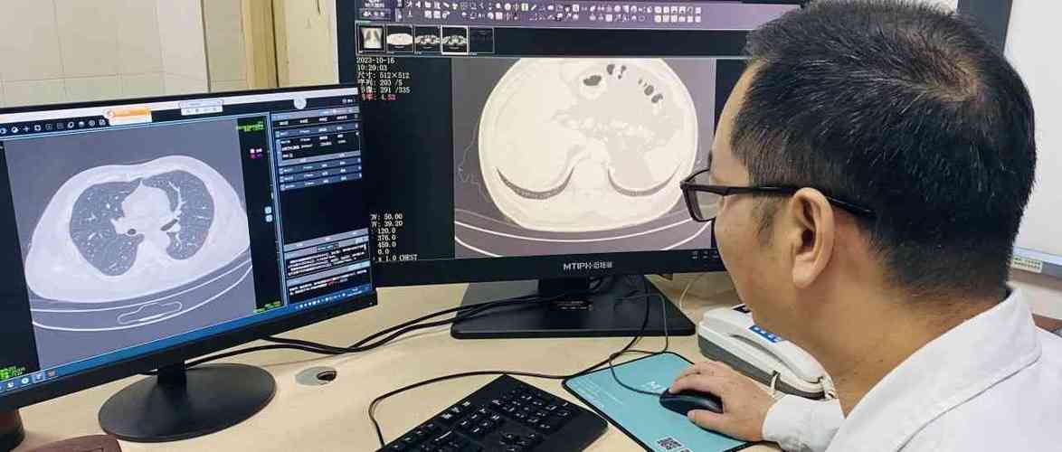 ct报告图标