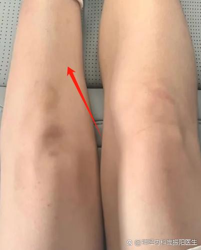感觉腿重的走不动是咋回事
