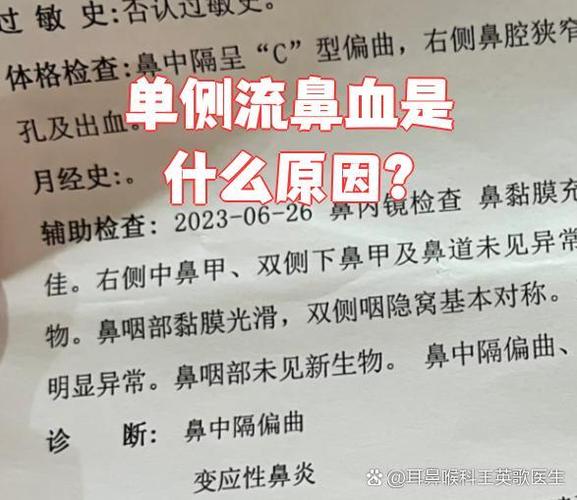 小孩单侧流鼻血是什么原因图标