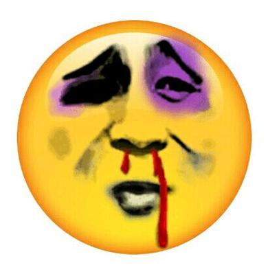 鼻青脸肿表情包emoji图标