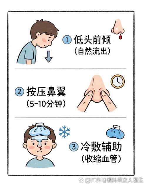 鼻血止住了怎么把纸取出来