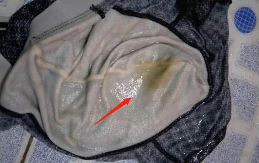 男性裤衩上有发黄分泌物图标