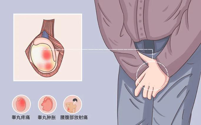 闲的蛋疼是什么意思图标