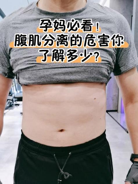 怀孕初期可以练腹肌吗图标