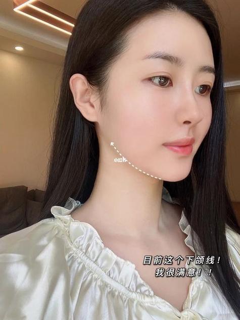 下巴肉松弛下垂怎么办缩略图