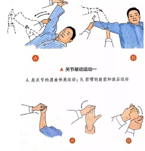 运动不协调怎么锻炼