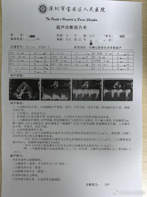 房颤心律不齐专用药