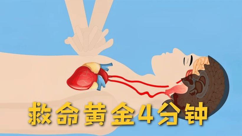 心患4ij黄位截图