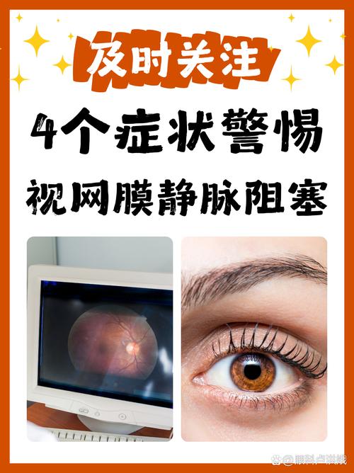 眼脉通广告截图
