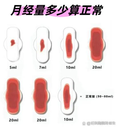 姨妈流量很少怎么回事截图