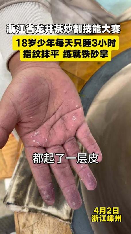 指纹磨平了多久能恢复图标