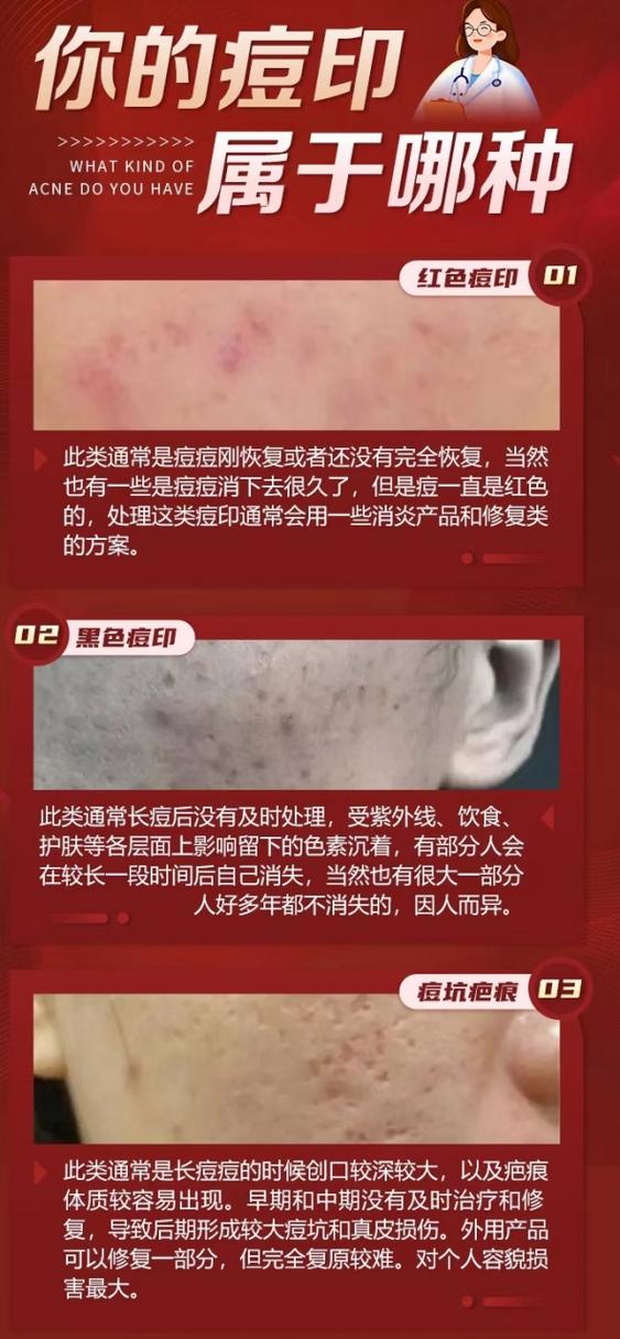 红色痘印会自己慢慢消失吗图标