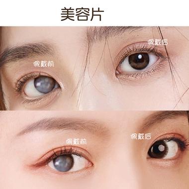 美瞳可以遮挡虹膜吗截图