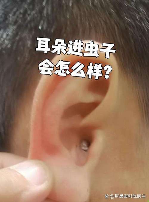 耳朵进虫子嗡嗡几声没反应了截图