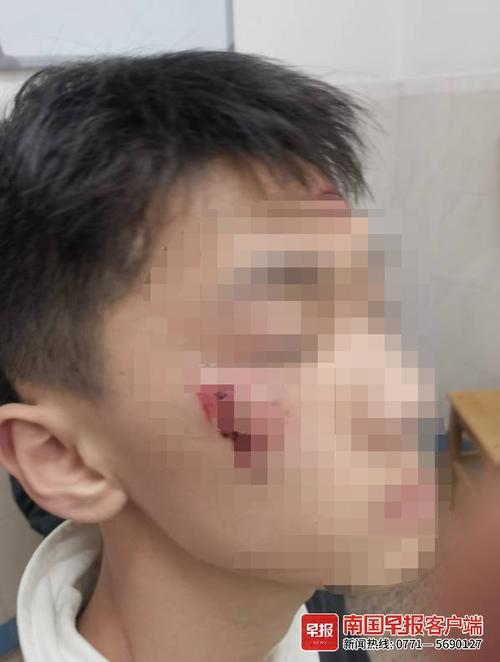 脸部被打伤的图片图标