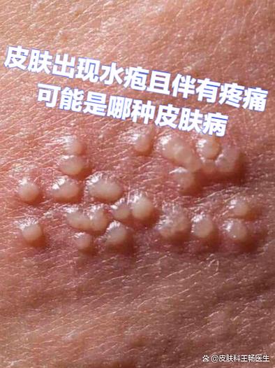百度扫一扫识别皮肤病入口图标