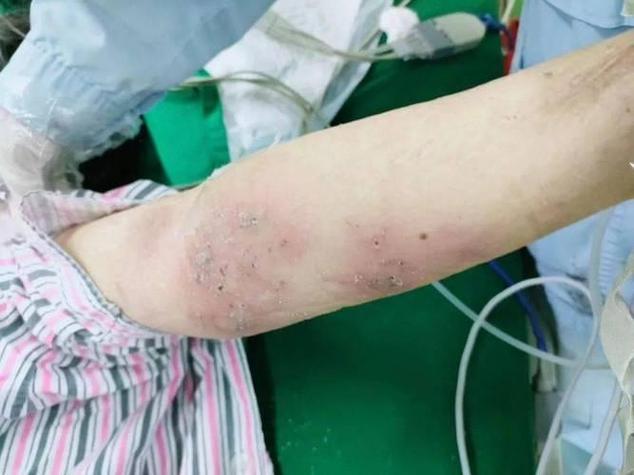被鼹鼠咬了怎么办图标