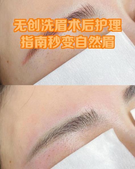 半永久做多久才能恢复自然?图标