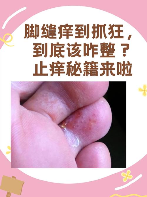 脚非常痒怎么办图标