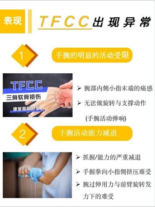 tfcc损伤的原因图标