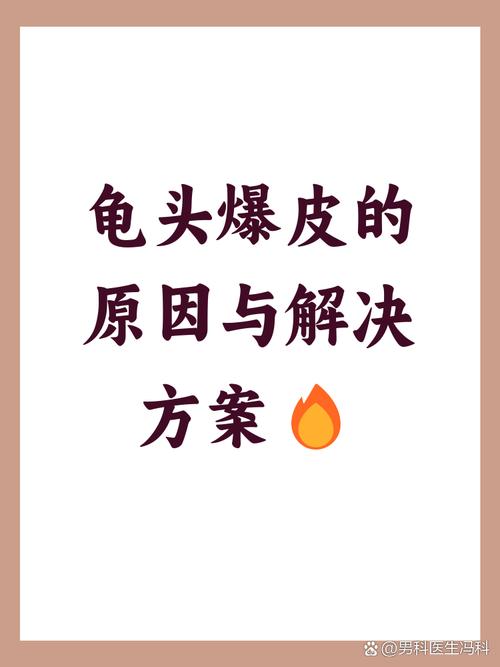 浚皮需求大吗图标