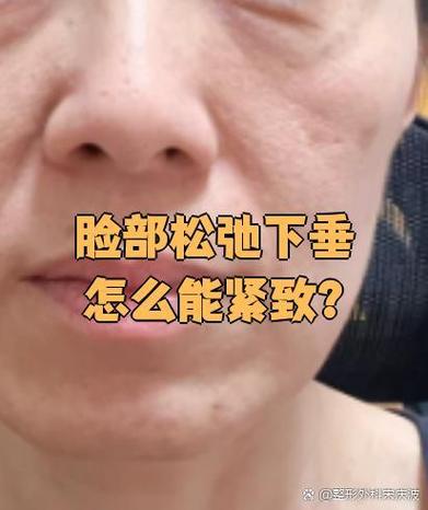 脸部松弛下垂如何改善图标