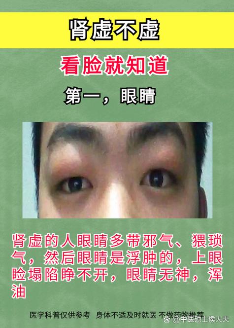 肾虚脸部的五大表现图标