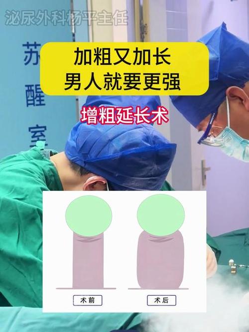 男人怎么加长加粗截图