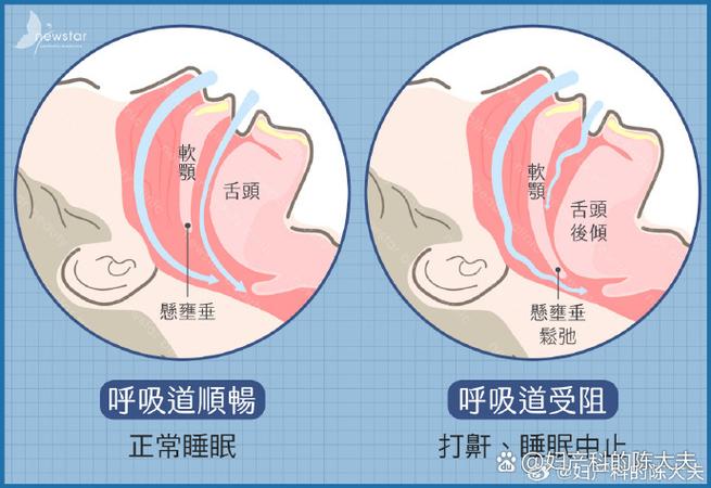 真人呼噜声mp3超大声图标