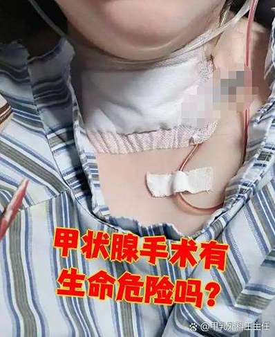 天津甲状腺肿瘤第一刀图标