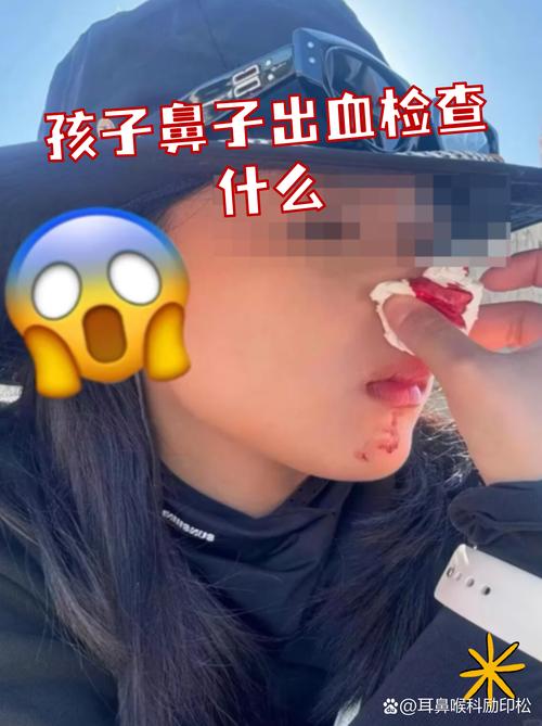 鼻子经常流鼻血是什么原因游戏截图