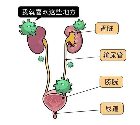 男生尿路感染有什么症状图标