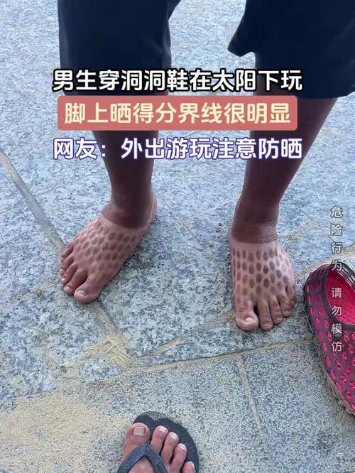 穿洞洞鞋的都是什么人图标