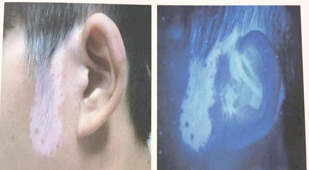 伍德灯颜色对照表蓝色图标