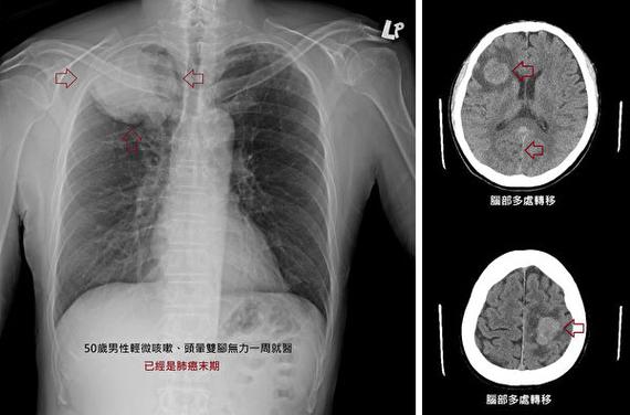 手机上如何查自己X光片子