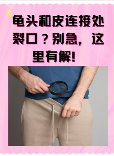 男人下体裂了一点皮截图