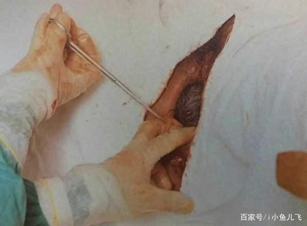 什么样的女人生孩子好看截图