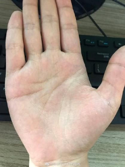 感情线中间断开又重叠接上图标