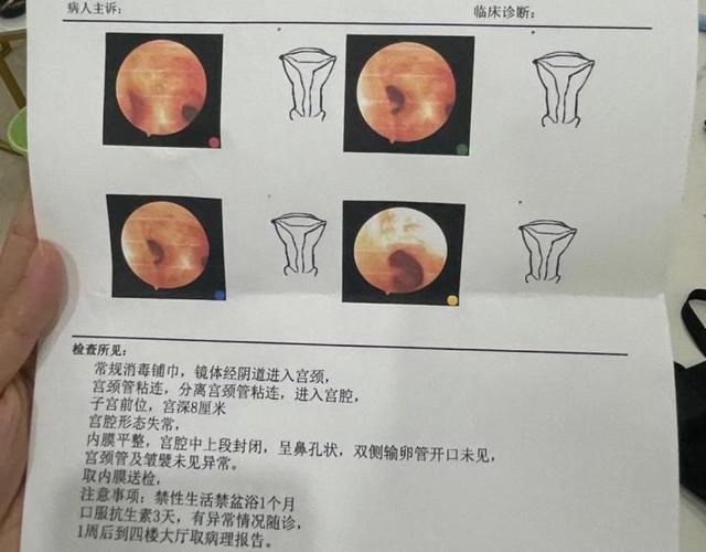 宫腔镜是什么意思图标