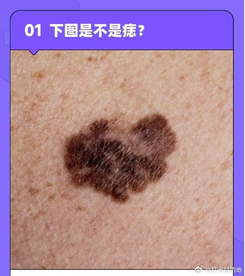照片黑点是什么意思啊图标