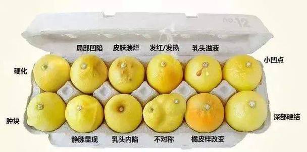乳头流出白色分泌物是怎么回事截图