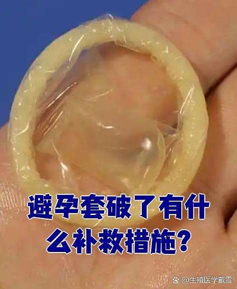 同房套破了怎么避孕图标