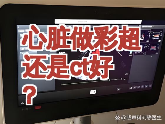 心脏做彩超还是CT好图标
