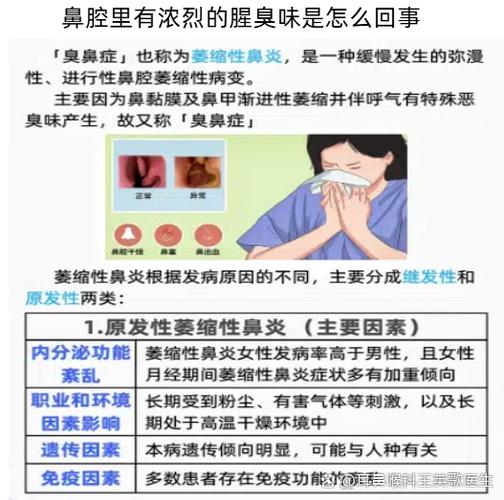 鼻子闻不了味道是怎么回事图标