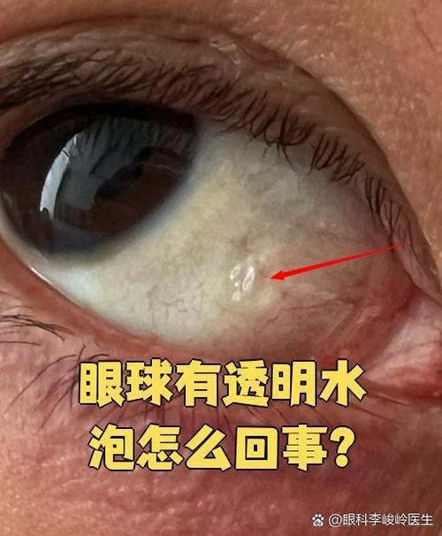 眼睛突然流眼睛水图标