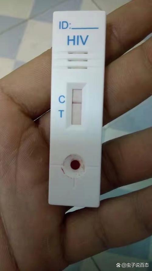正常人hiv报告单图标
