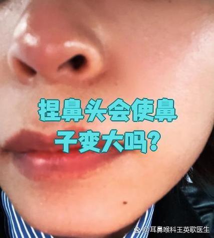 总是揉鼻子鼻子会变大吗图标