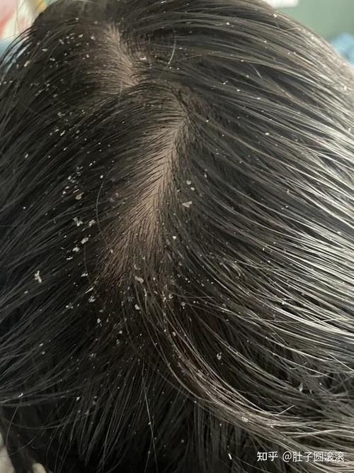 头发上可以抠出很多白色的图标
