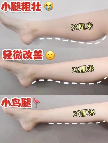 怎样练让小腿变粗壮截图