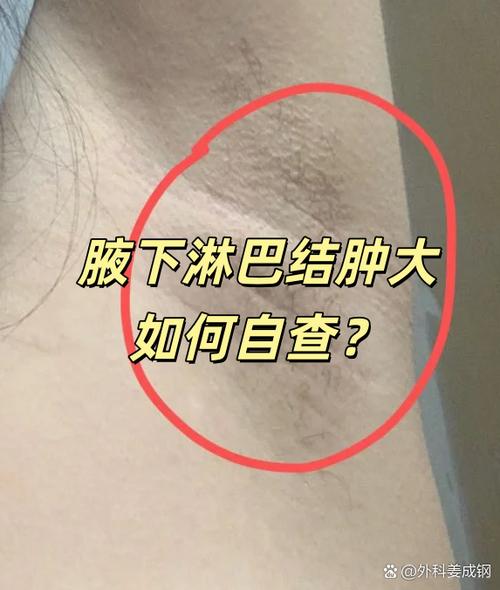 腋下淋巴结肿大的原因图标